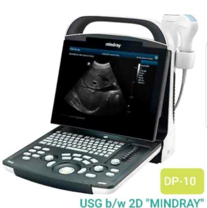 Jual Usg 2D Mindray Dp10 / Usg Dp 10 Mindray New Version Black Edition ...