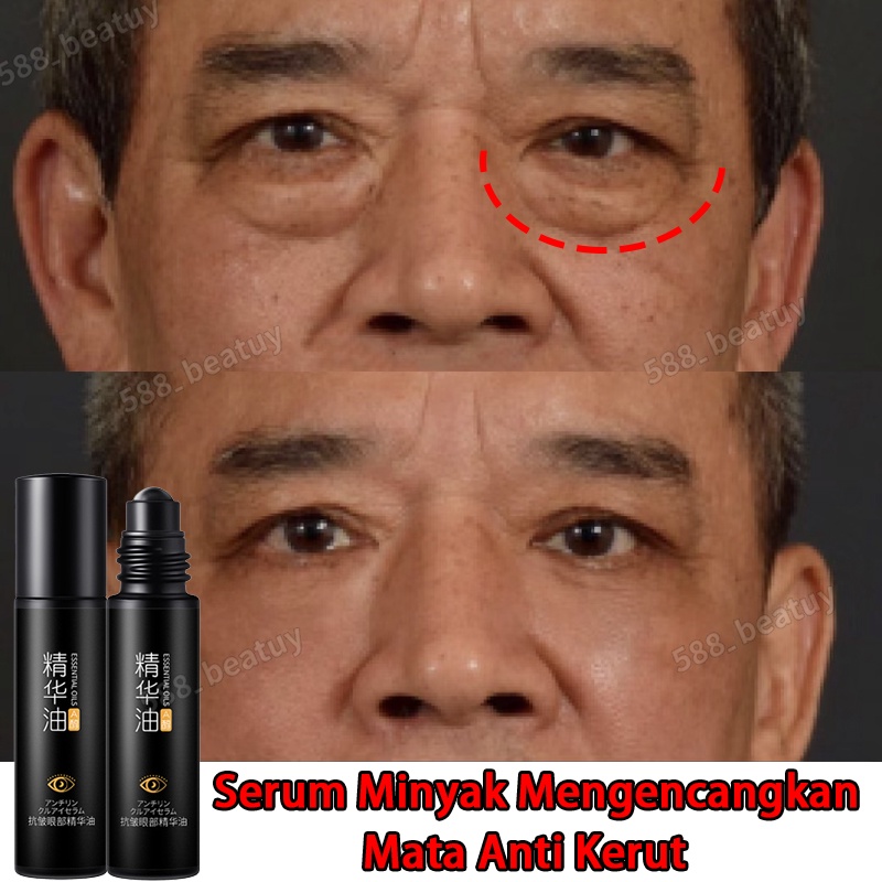Jual Minyak Esensi Mata Anti Kerut Penghilang Lingkaran Hitam Mata ...