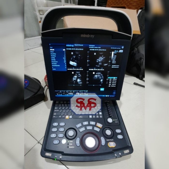 Jual USG DP-10 MINDRAY PLUS DOPPLER DAN PROBE | Shopee Indonesia