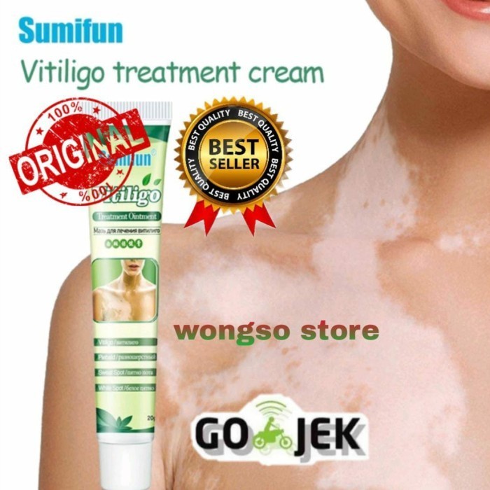 Jual Obat kulit VITILIGO Salep Cream Penghilang Bercak Putih Belang ...