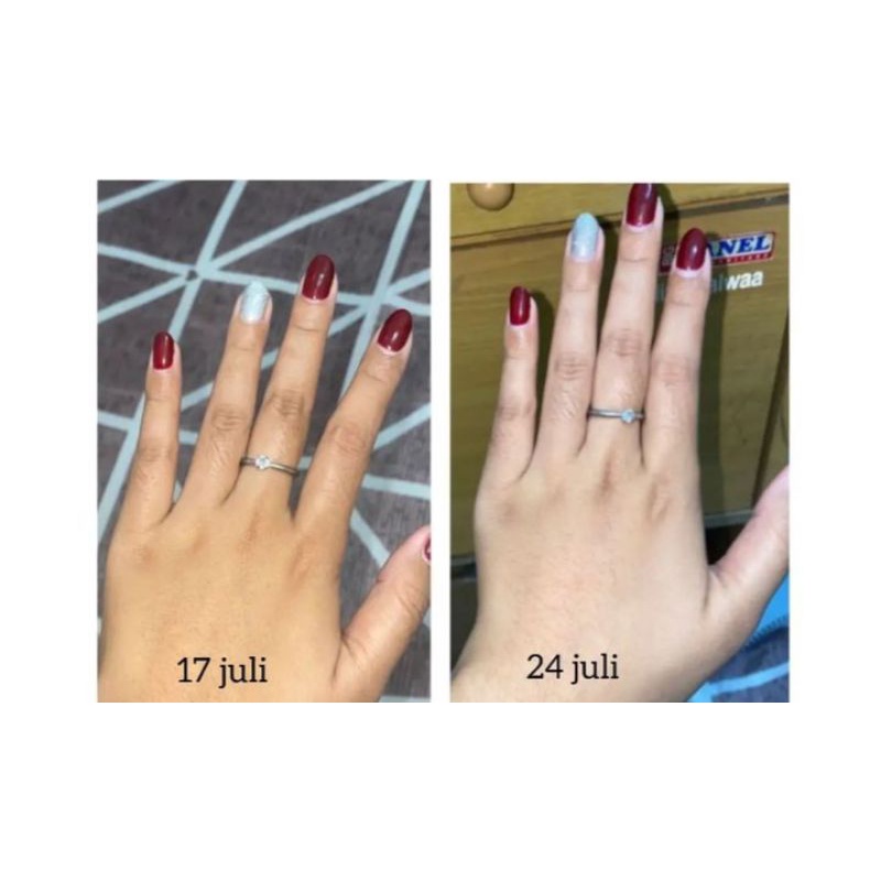 Jual Handbody injeksi whitening ( untuk kulit susah putih ) | Shopee ...