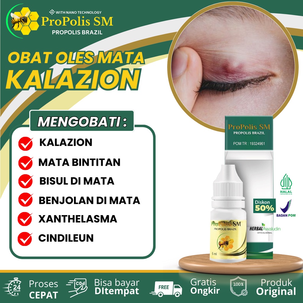 Jual Obat Oles Pengempis Benjolan di Kelopak Mata - Salep Pengempis ...