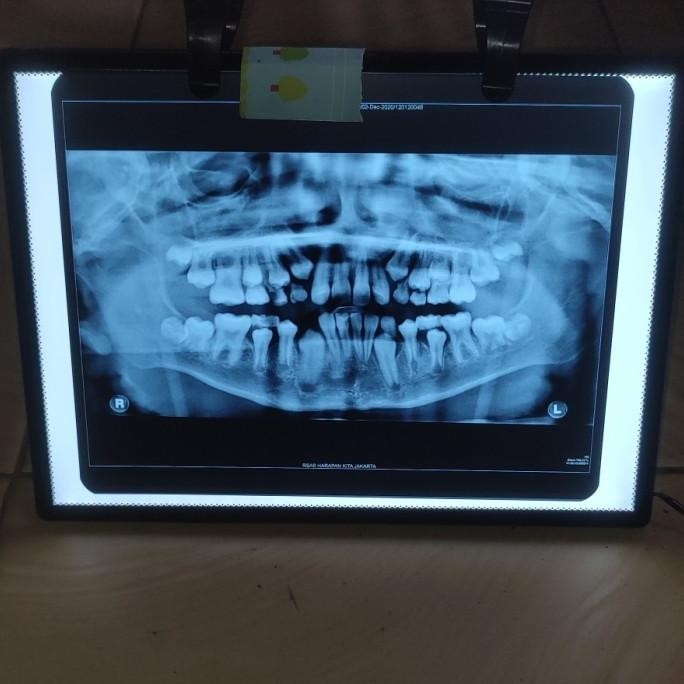 Jual Dental viewer X ray LED rontgen A4 slim / lampu baca rontgen ...