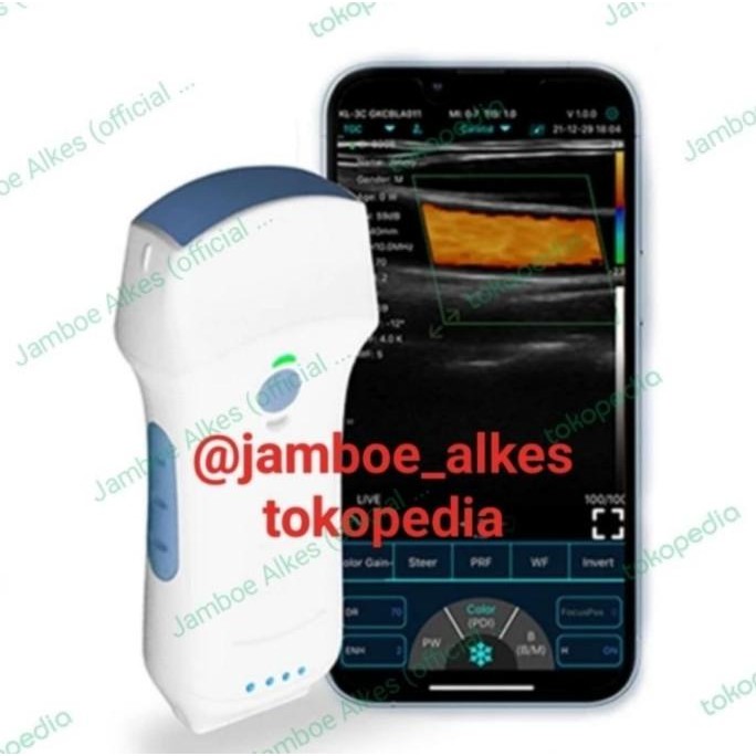 Jual USG 2 Head Wireless/Ultrasound probe 3in1 (Convex, Linear ...