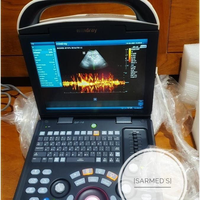 Jual Usg Dp-10 Mindray Plus Doppler Dan Probe | Shopee Indonesia