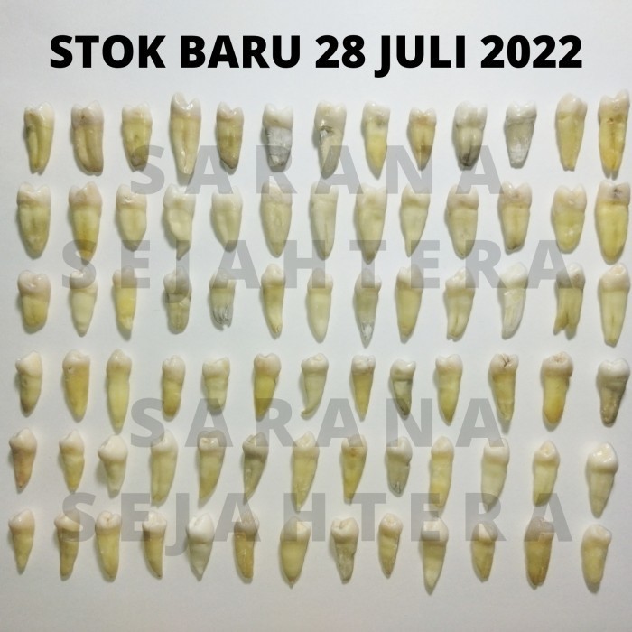 Jual Gigi Asli Posterior Untuk Praktikum (Gigi Premolar / Gigi Molar ...