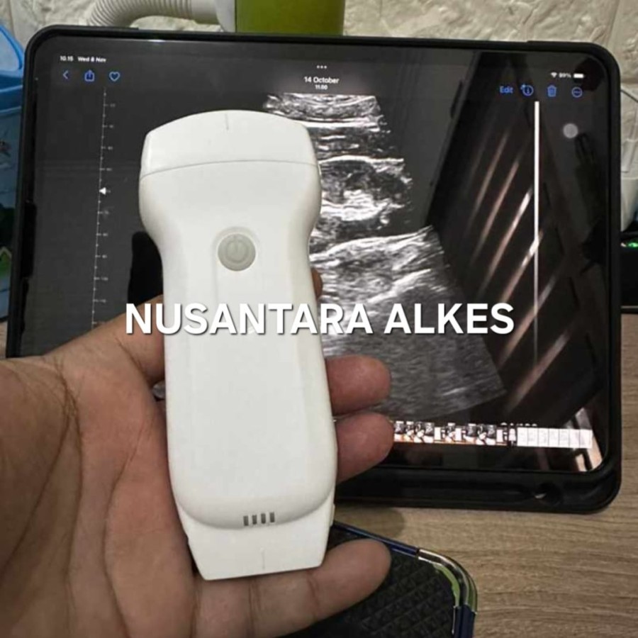 Jual USG Wireless Konted C10RL | Shopee Indonesia