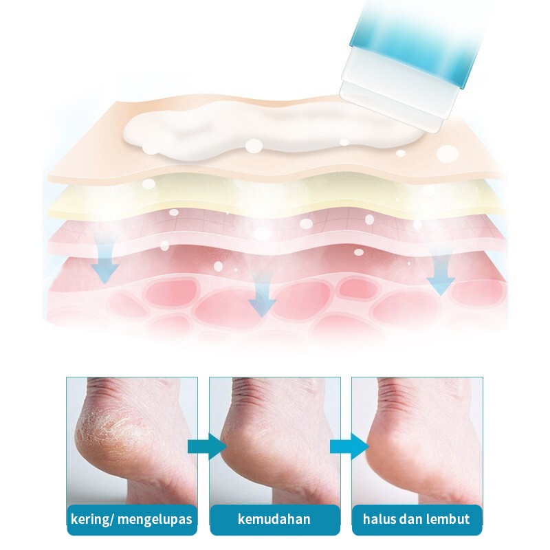 Jual Obat Kaki Pecah Dan Kering Ampuh Foot&Heel Cream -Tangan Kaki ...