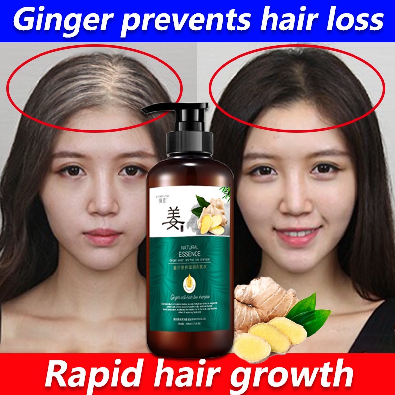 Jual Original Natural Ginger Shampoo for Hair Loss Herbal Ginger ...