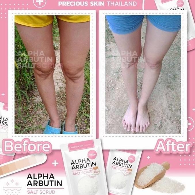 Jual TERBARU Alpha Arbutin Salt Scrub / Body Scrub / Scrub Badan ...