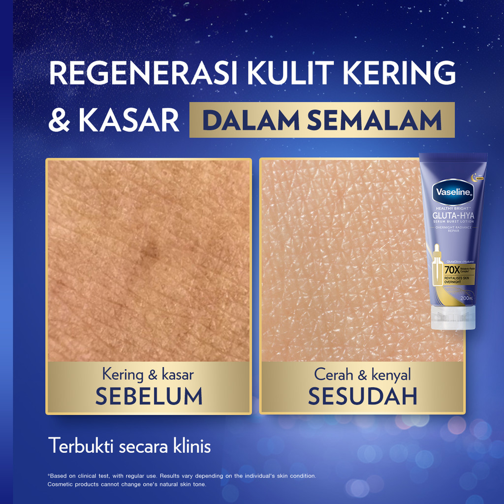 Jual Buy Vaseline Gluta Hya Overnight 330ml Free Vaseline Gluta Hya Flawless 20ml | Shopee Indonesia