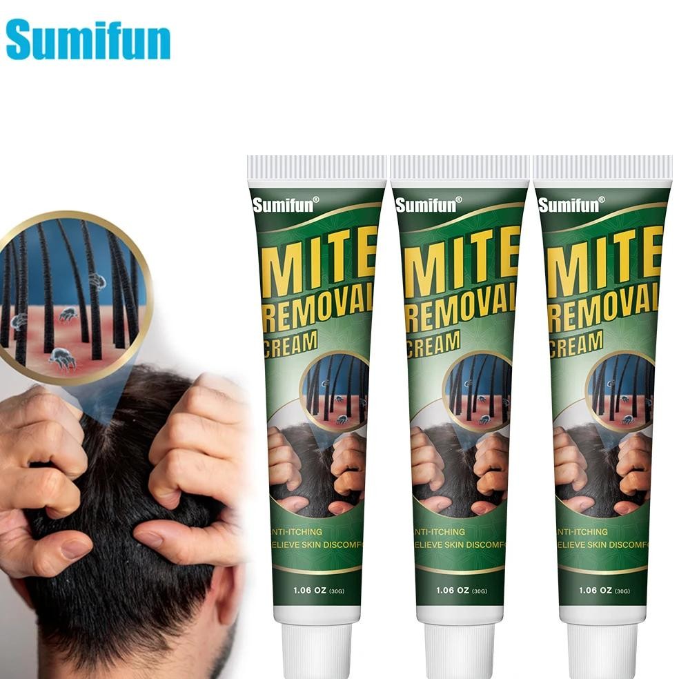 Jual Sumifun Mite Removal Cream Kill Lice Ointment Scabies Treatment ...