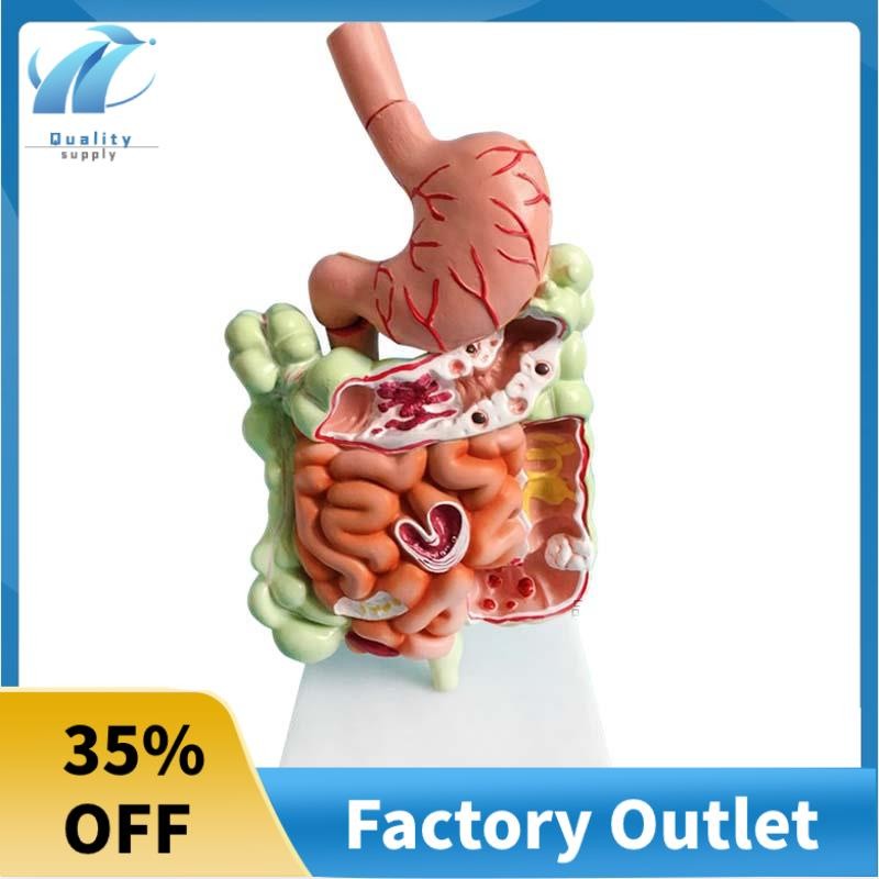 Jual Model Sistem Pencernaan Manusia Yang Luar Biasa Anatomi Perut ...