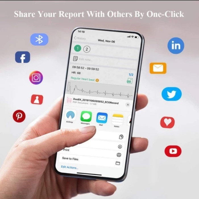 Jual Ready Gas!!! Wearable Ecg Holter Heart Monitor Portable Ecg ...