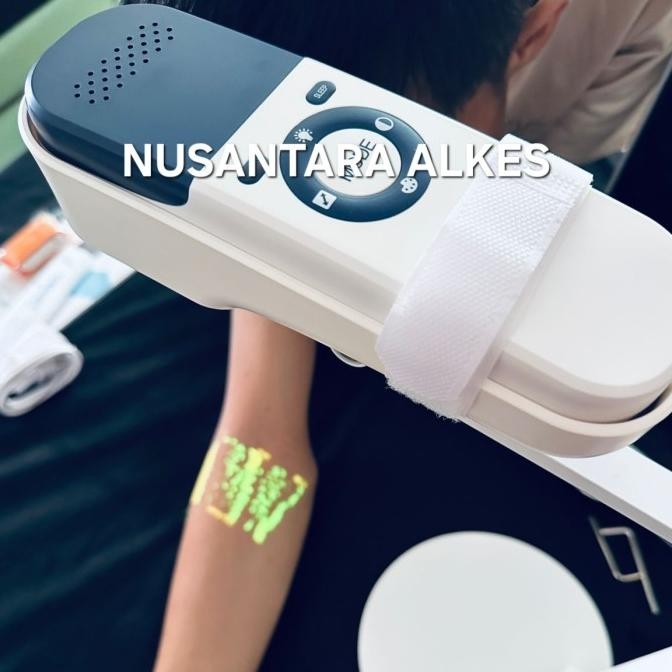 Jual Alat Pencari Vena / Vein Finder / Vein Illuminator / Vena Viewer ...