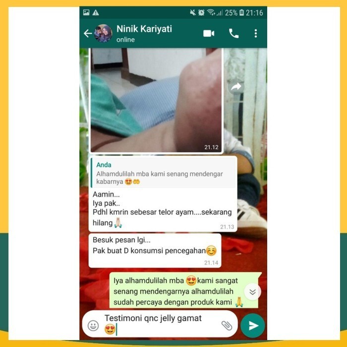 Jual Obat Gondongan, Pipi Dan Leher Sekitar Rahang Bengkak, Parotitis ...