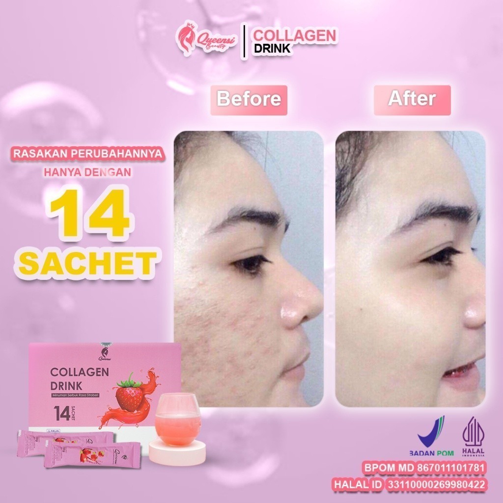 Jual Original Bpom > [Hemat] Promo Terbatas Queensi Collagen Drink Strawberry With Collagen ...