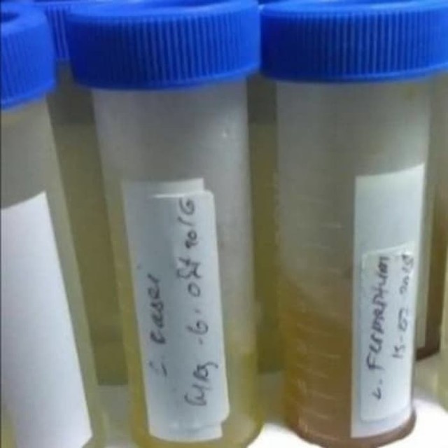 Jual Kultur Jamur Saccharomyces cerevisiae: Jamur Penghasil etanol ...
