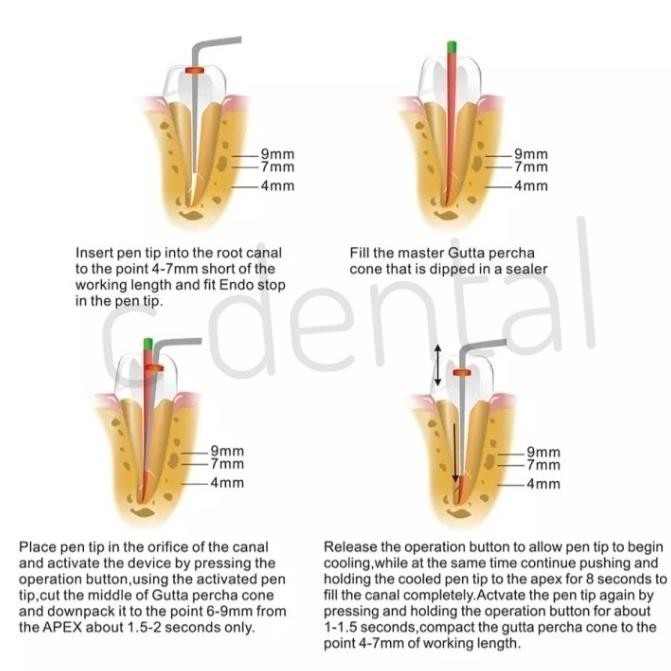 Jual Dental Endodontic Obturation Gutta Percha Plugger Pen Heated Tip ...
