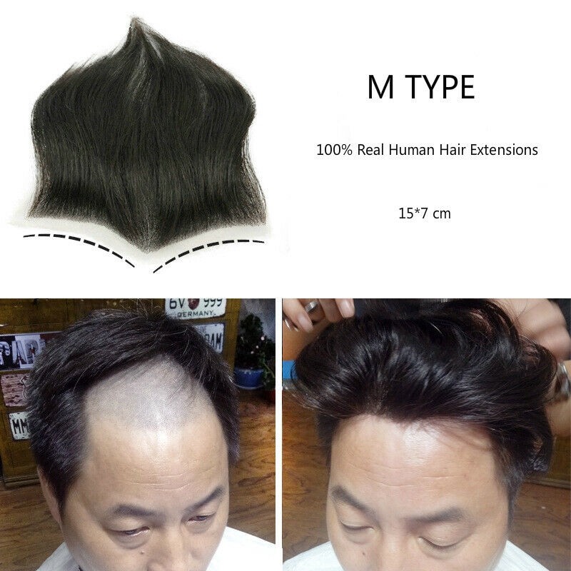 Jual Wig Rambut Palsu Poli Pengganti Rambut Manusia Asli Garis Rambut ...