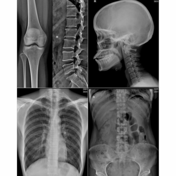 Jual Medical Dry Film Radiology ( Blue Inkjet Film ) A3 | Shopee Indonesia