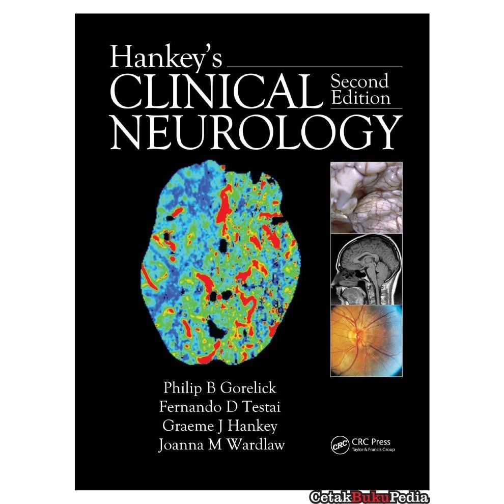 Jual Book Hankey'S Clinical Neurology Second Edition Softcover | Shopee Indonesia