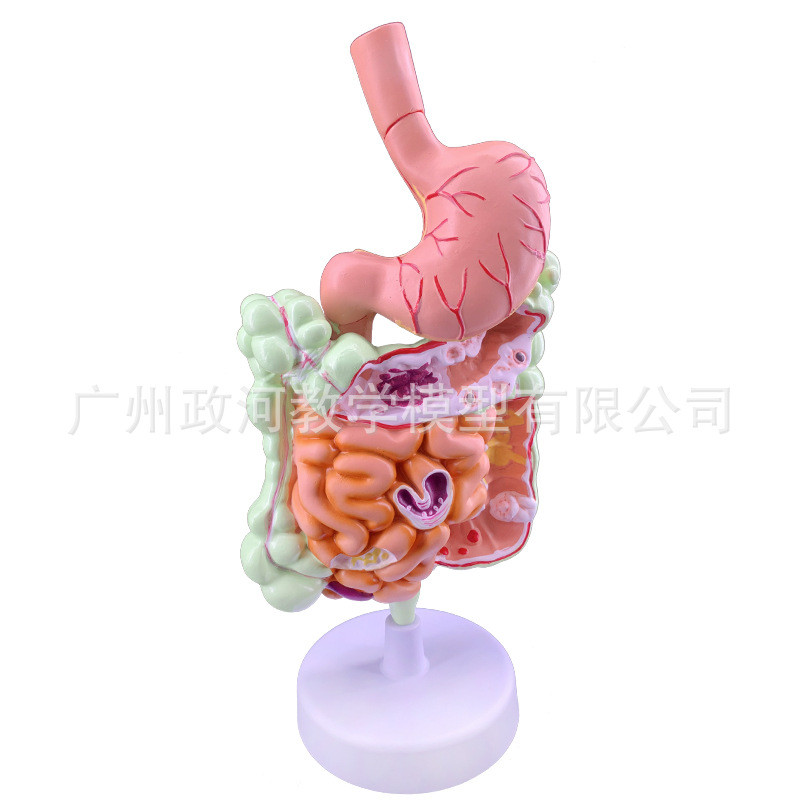 Jual Al Mubarokk |Anatomical Human Digestive System Model Stomach ...
