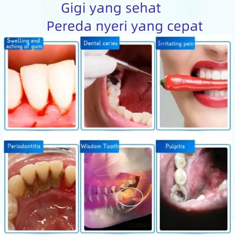 Jual Obat Sakit Gigi Berlubang Paling Ampuh Penghilang Gusi Bengkak ...