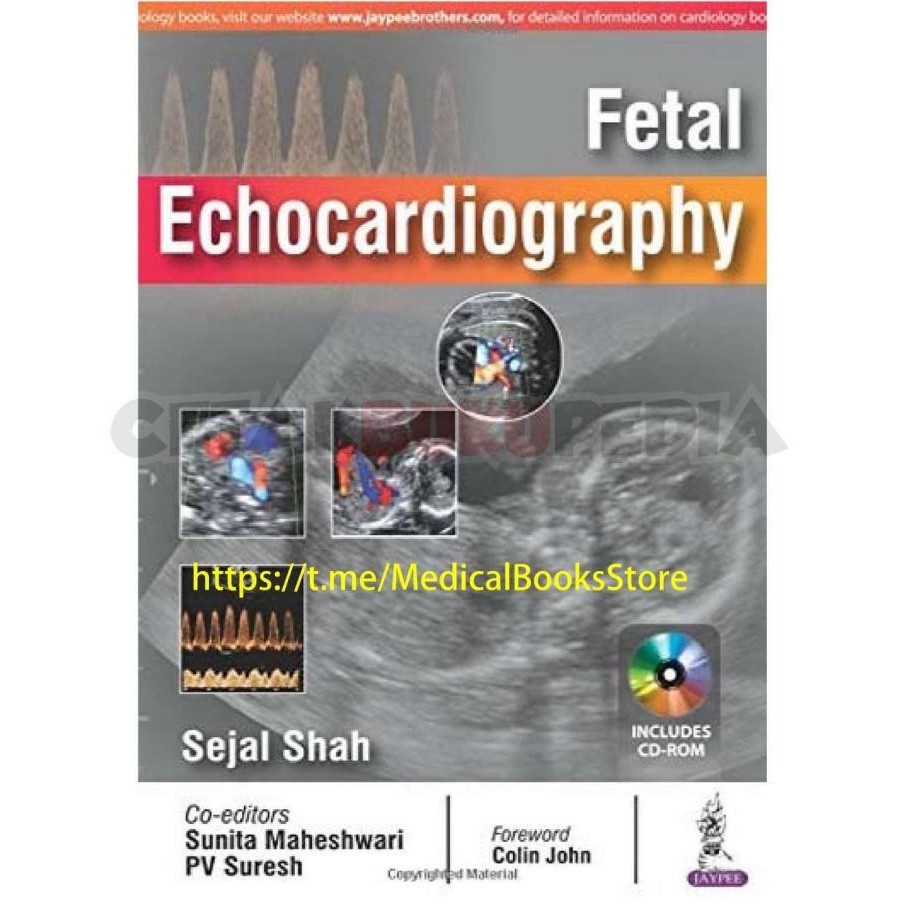 Jual Fetal Echocardiography 1St Ed Sejal Shah Nocdrom Softcover | Shopee Indonesia