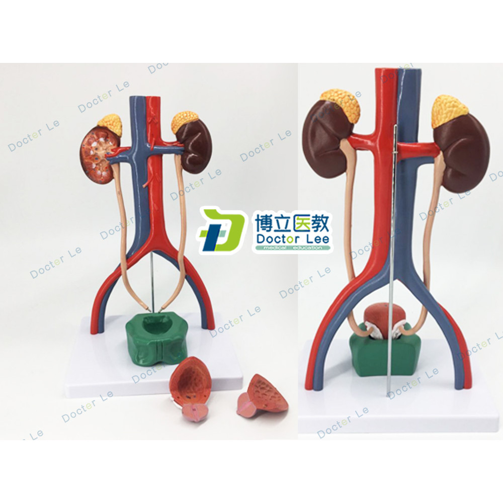 Jual GERAI SUKSES Human Urinary System Anatomical Model Kidney Ureter ...