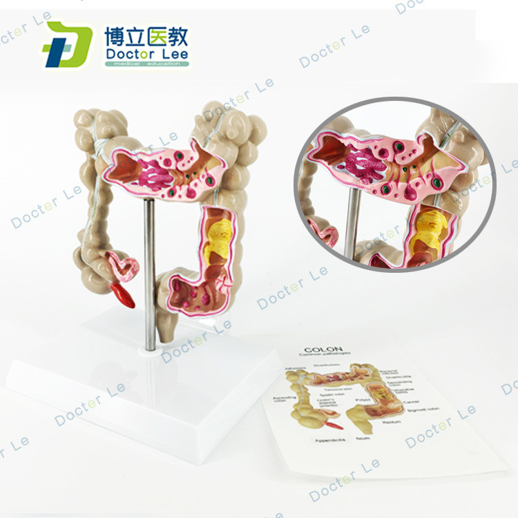 Jual GERAI SUKSES 1/2 Life Sized Medical Human Anatomy Intestine Model ...