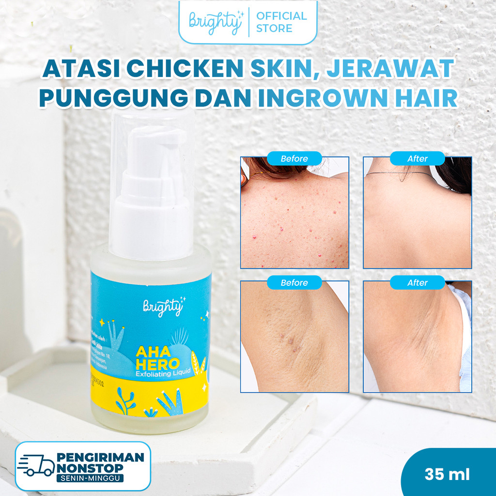 Jual Brighty Aha Hero Exfoliating Liquid Serum Pencerah Ketiak Chicken ...