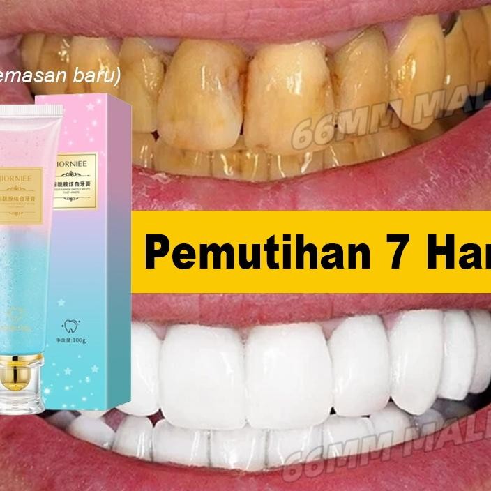 Jual Odol Pemutih Gi 100G Pata Gi Pemutih Gi Uning Permanen Cepat ...