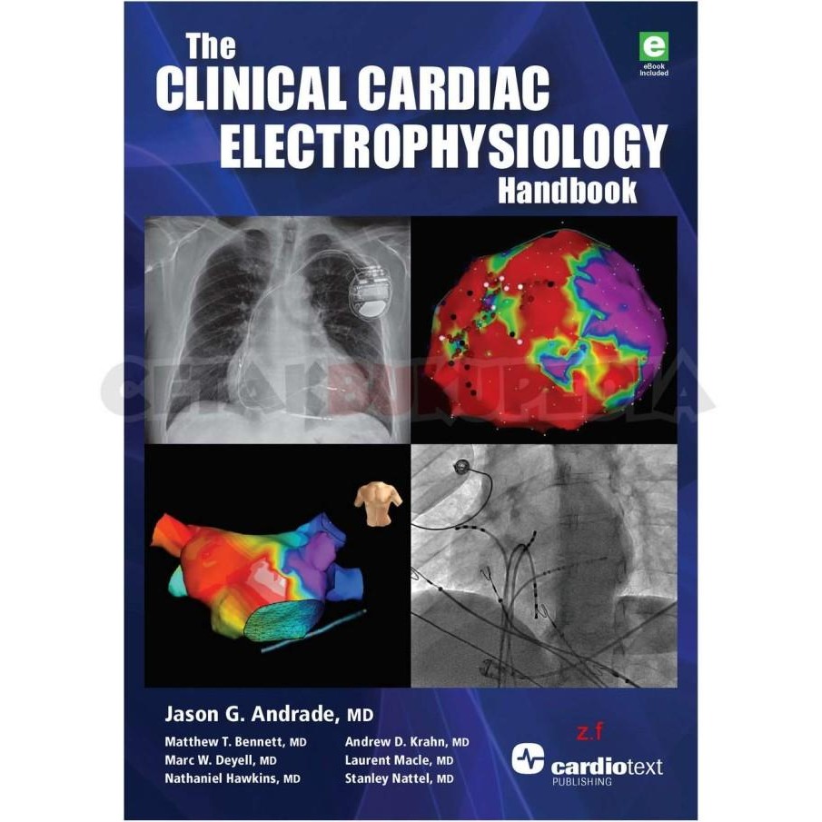 Jual Buku Po Clinical Cardiac Electrophysiology Handbook Jason Softcover | Shopee Indonesia