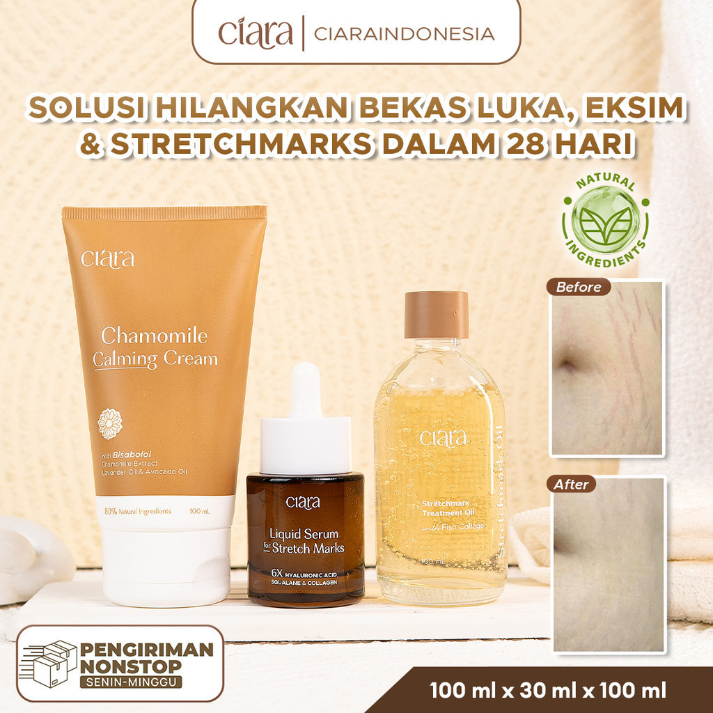 Jual Ciara Chamomile Calming Cream X Stretchmarks Treatment Oil X ...