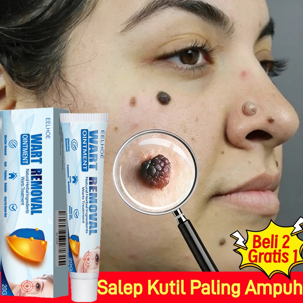 Jual Salep Kutil Paling Ampuh Penghilang Tahi Lalat Di Wajah Penghilang ...