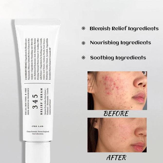 Jual 345 Relief Cream Daily Face Moisturizer Blemish Relief Care ...