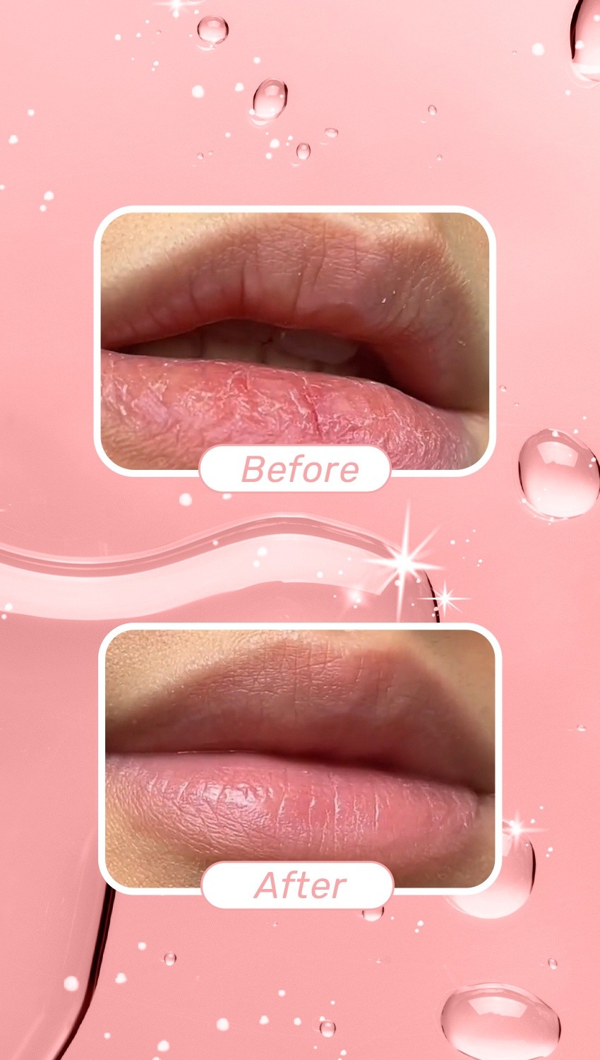 Jual JIERA Advanced Lip Serum 10ml with Vitamin C dan Duo Vitamin E ...