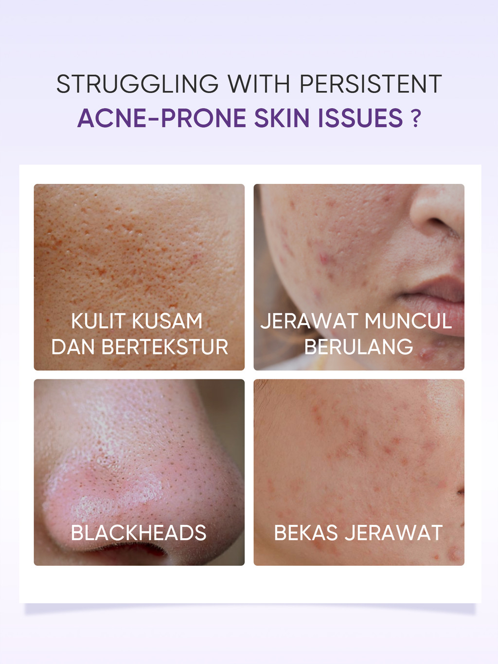 Jual SKINTIFIC - Lactic Acid Skin Renewal Exfoliating Serum 20ml ...