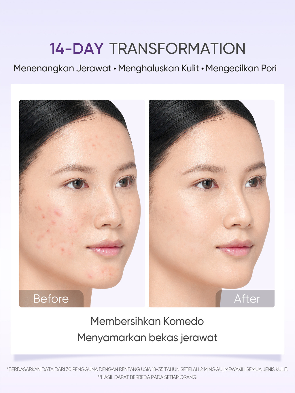Jual SKINTIFIC - Lactic Acid Skin Renewal Exfoliating Serum 20ml ...