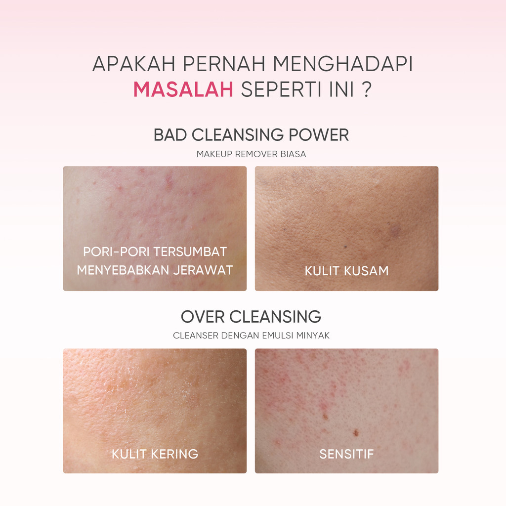 Jual SKINTIFIC - Zero Oil Cleansing Balm 100ml | Pembersih Cleanser ...
