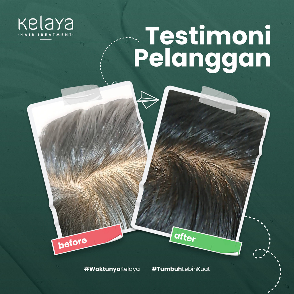 Jual Kelaya Shampoo Non SLS Gentle Hair Essence 250ml Hair Care Sampo ...