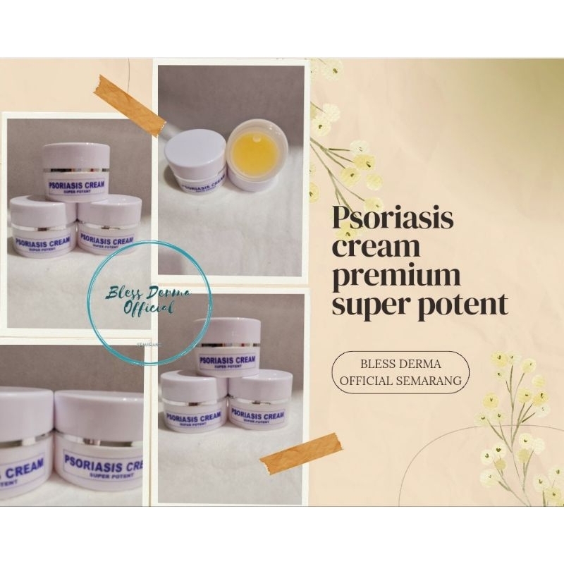 Jual TERBUKTI AMPUH !! Psoriasis Cream Premium Super Potent Obat Gatal ...