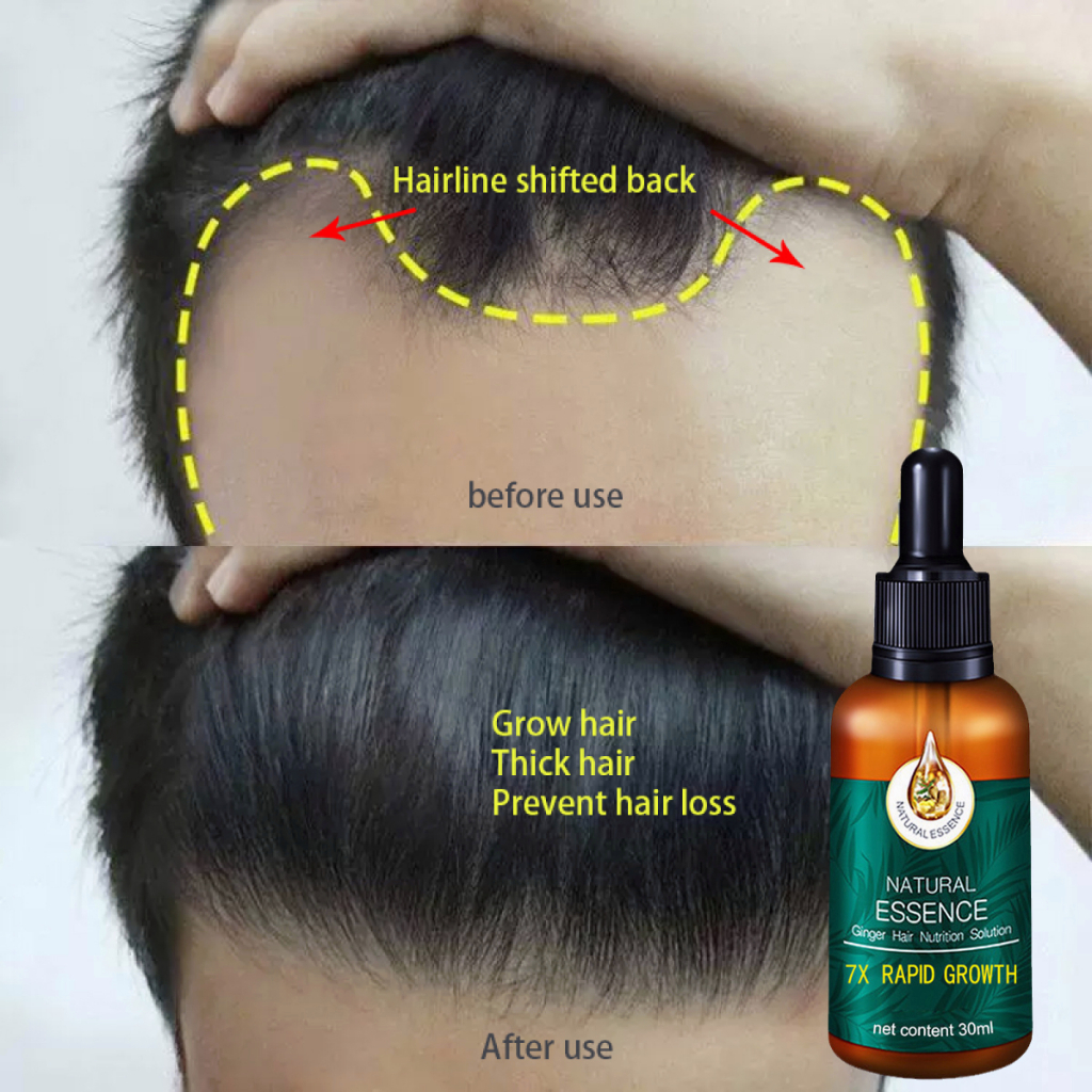 Jual [100% Asli ] Penebal Rambut、obat penumbuh rambut、anti rambut ...