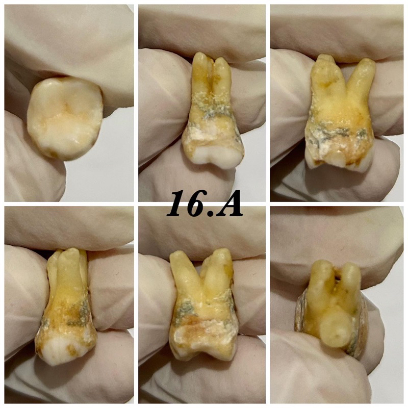 Jual JUAL GIGI ASLI PRAKTIKUM / GIGI MANUSIA / KEDOKTERAN GIGI | Shopee Indonesia