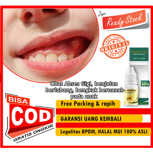 Jual PROPOLIS SM - Obat Abses Gigi, benjolan, berlubang, bengkak ...