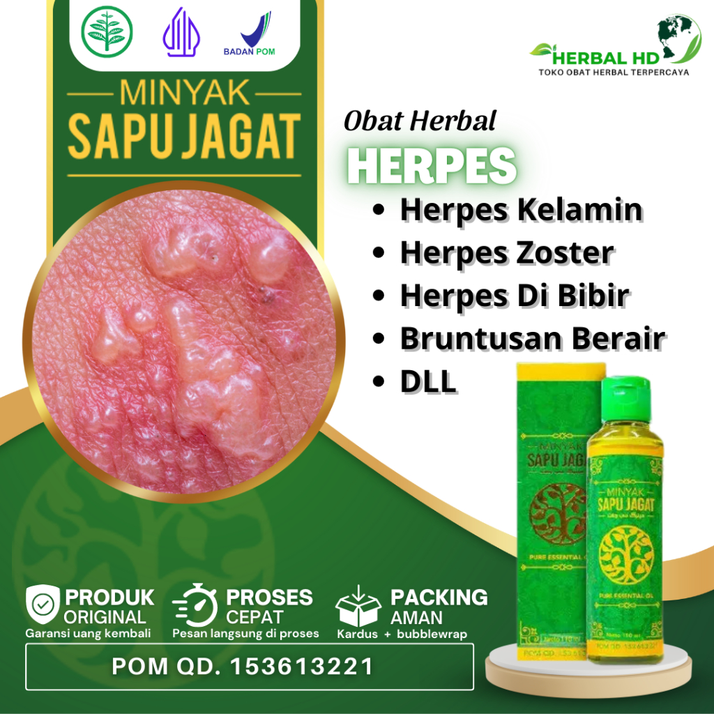 Jual Obat Oles Herpes Kulit HSV, Obat Kulit Kering, Obat Luka Lepuh ...