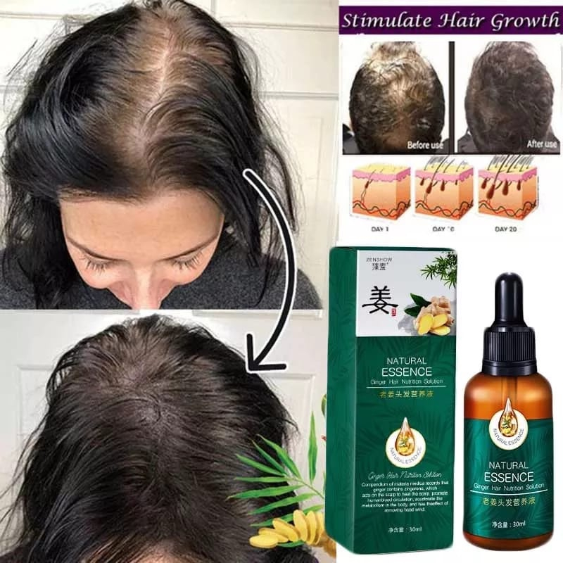 Jual NATURAL ESSENCE GINGER SERUM PENUMBUH RAMBUT ANTI RONTOK ANTI ...