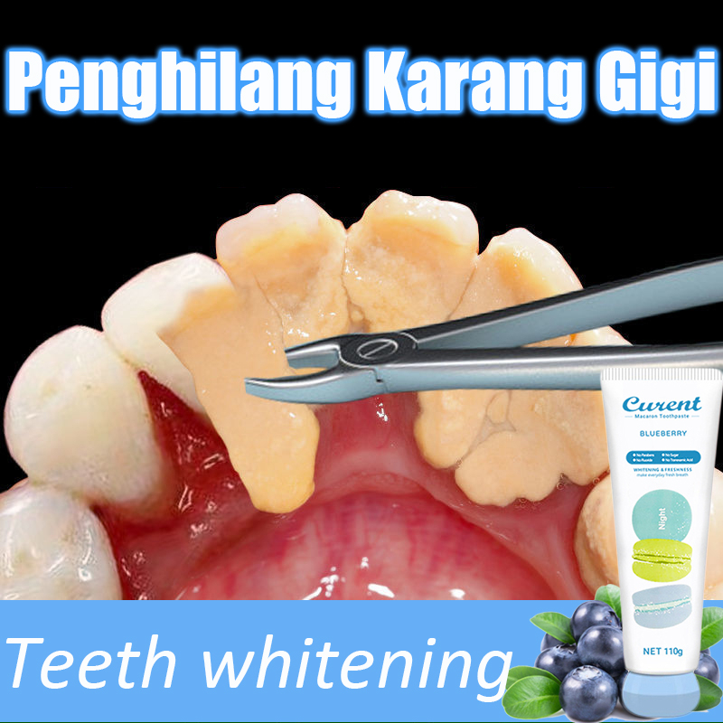 Jual Pasta gigi pemutih gigi dan penghilang karang gigi pembersih ...