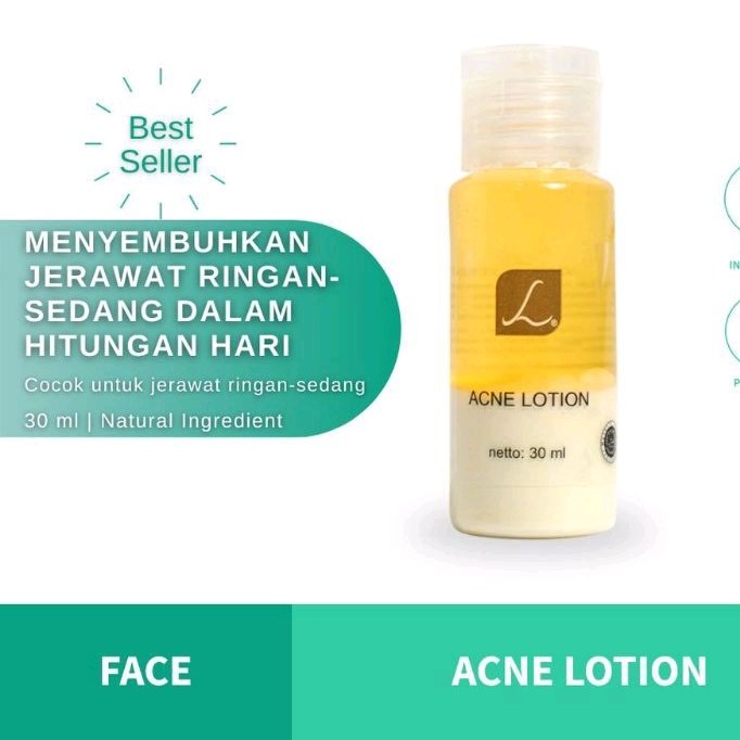 Jual Larissa Acne Lotion(obat jerawat) | Shopee Indonesia
